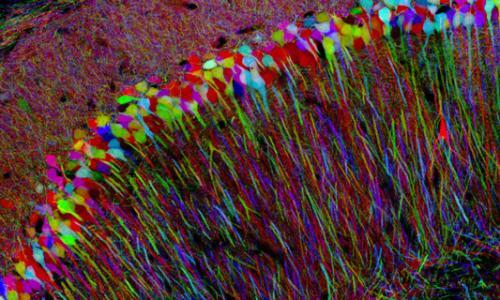 How I Learned to Love Neuroplasticity — And Why You Should, Too – Fancy ...